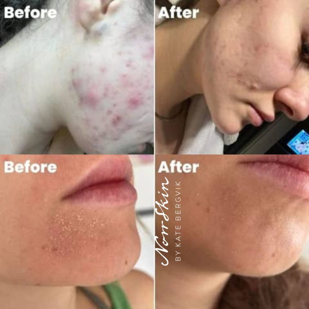 Natural Night Repair Face Mask